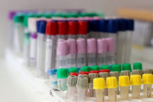 How LIS Can Optimize Laboratory Workflows [Infographic] - Aspyra